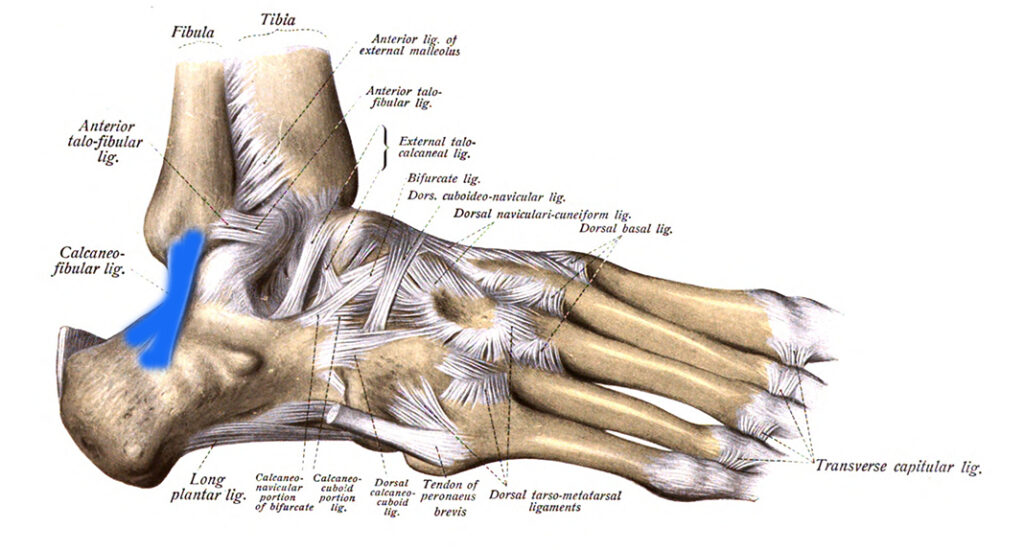 O Ligamento Peroneo-Calcaneano Tem Variáveis Anatómicas Que Até Agora ...